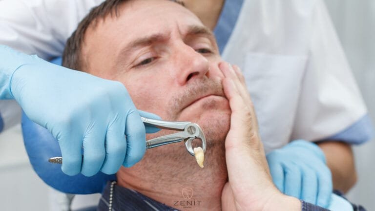 Extraction of Embedded Tooth - Zenit Dent 2025